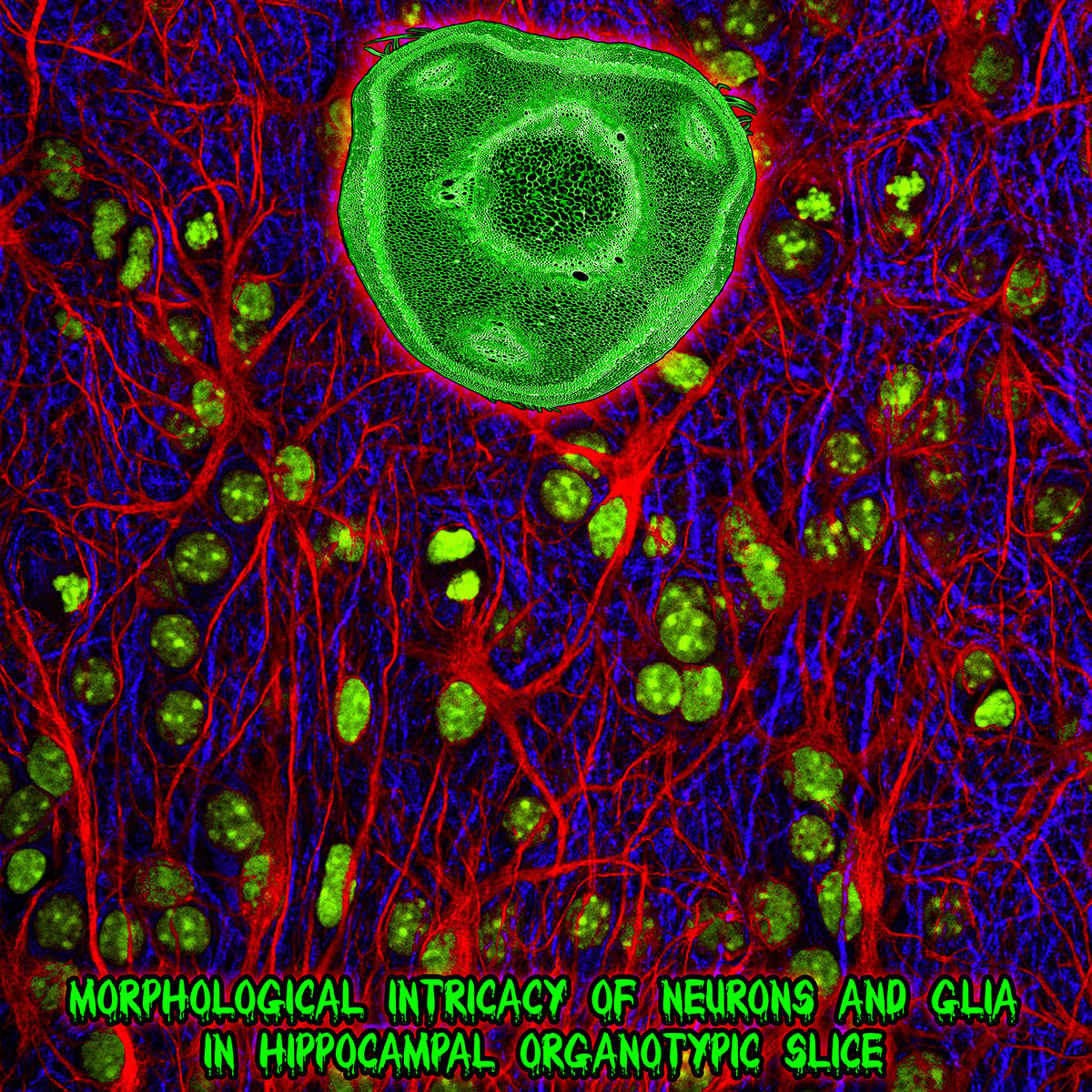 Morphological Intricacy of Neurons and Glia in Hippocampal Organotypic ...