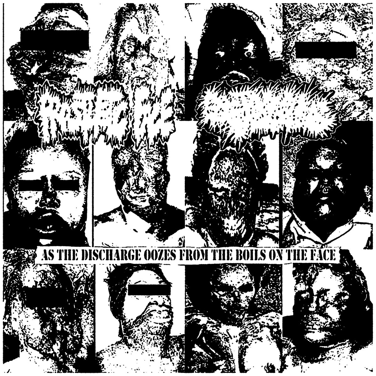 PROSTHETIC FACE / SKIN BEETLES - As The Discharge Oozes From The Boils ...