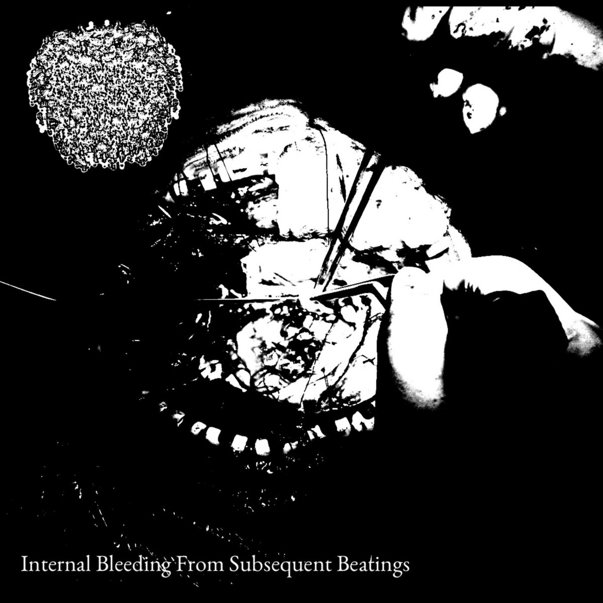 Internal Bleeding from Subsequent Beatings (DEMO) | Splayed
