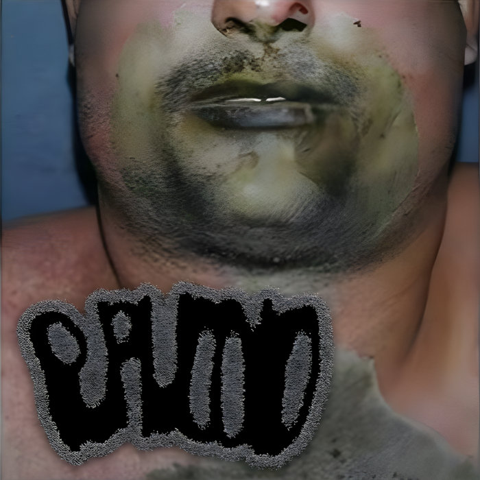 Endotracheal Intubation as a Conduit to administer a Life-Saving Opiate ...