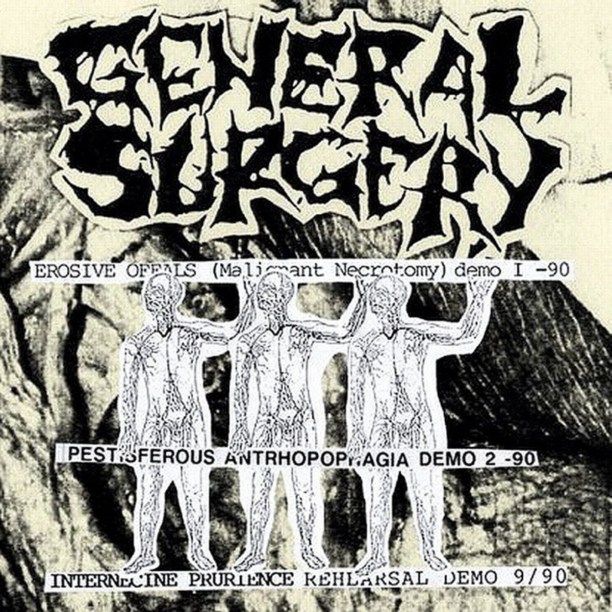 Demos | General Surgery | Nuclear Abominations Records