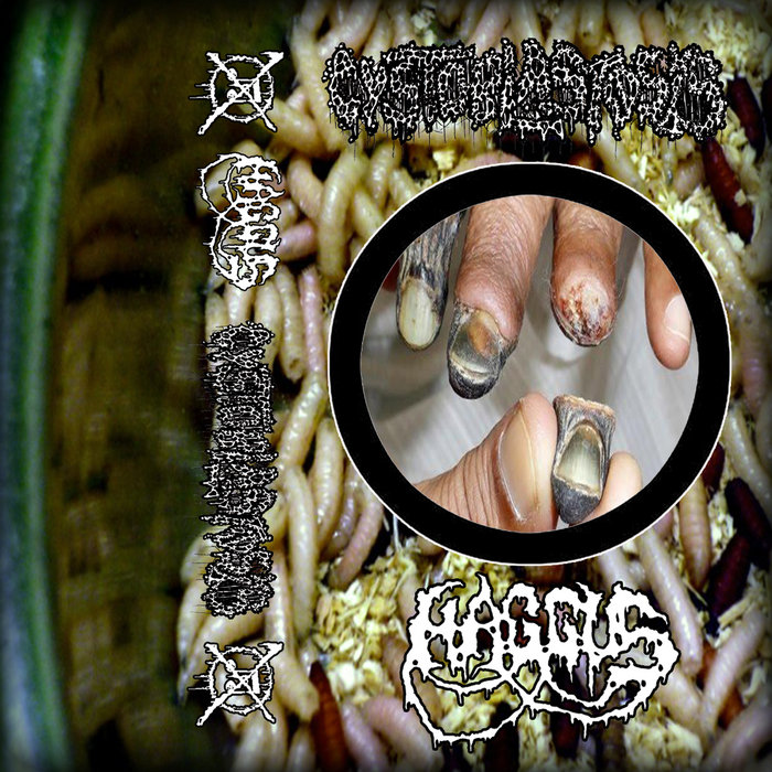 split w Haggus | Cystoblastosis