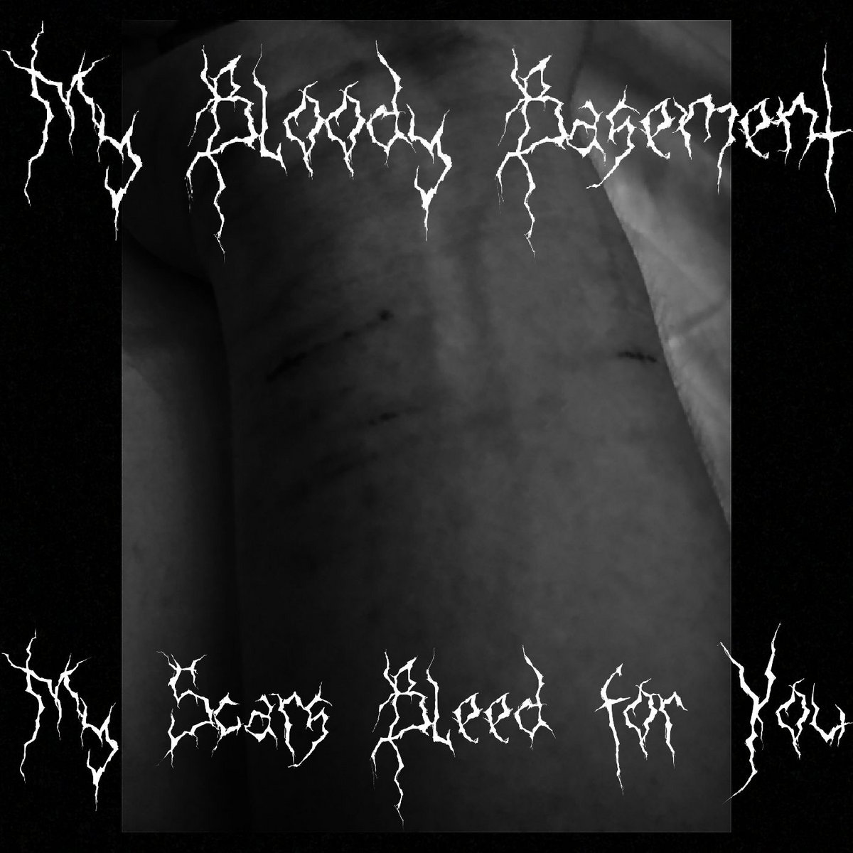 My Scars Bleed for You | My Bloody Basement