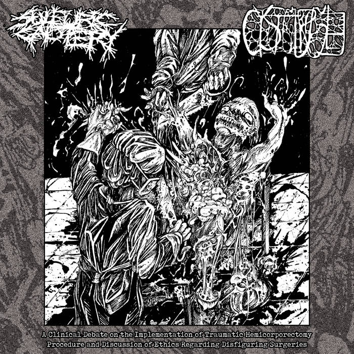 A Clinical Debate On The Implementation Of Traumatic Hemicorporectomy ...