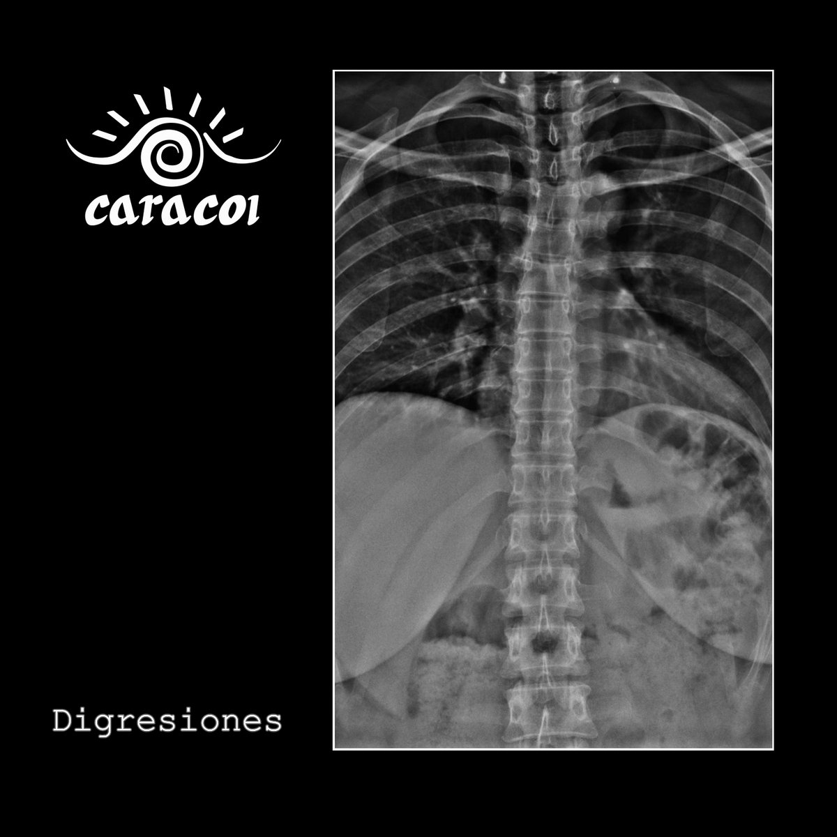 Digresiones | Caracol