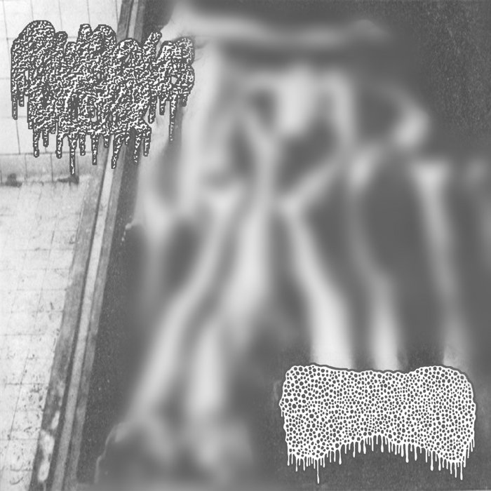 Split with Bulbous Ulcer | Bulbous Ulcer, Lymphoedema | Lymphoedema