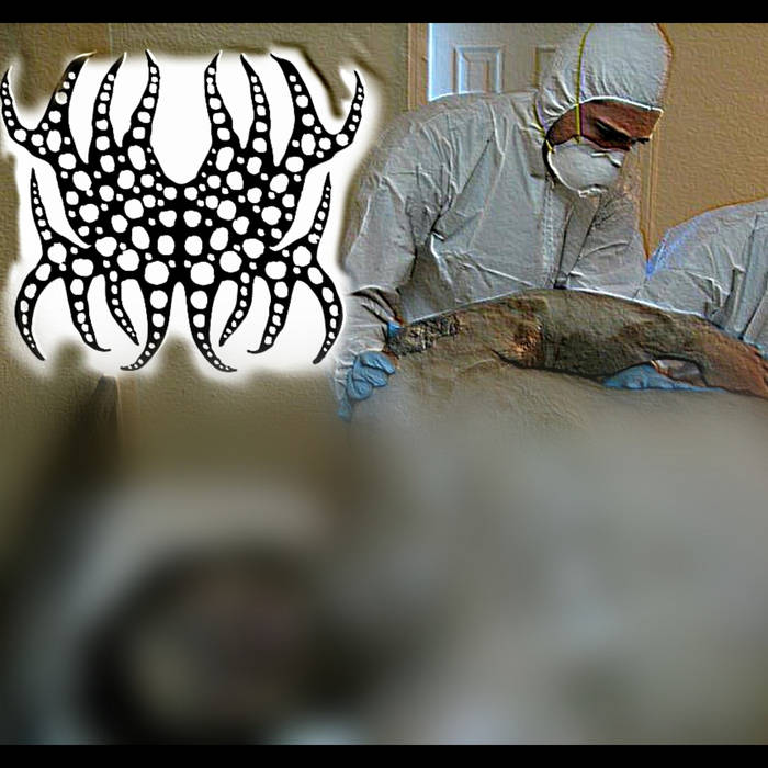 Obese Bloated Body Putrefaction | DxBxAxIxRxHxFx | Degenerates Boiled ...