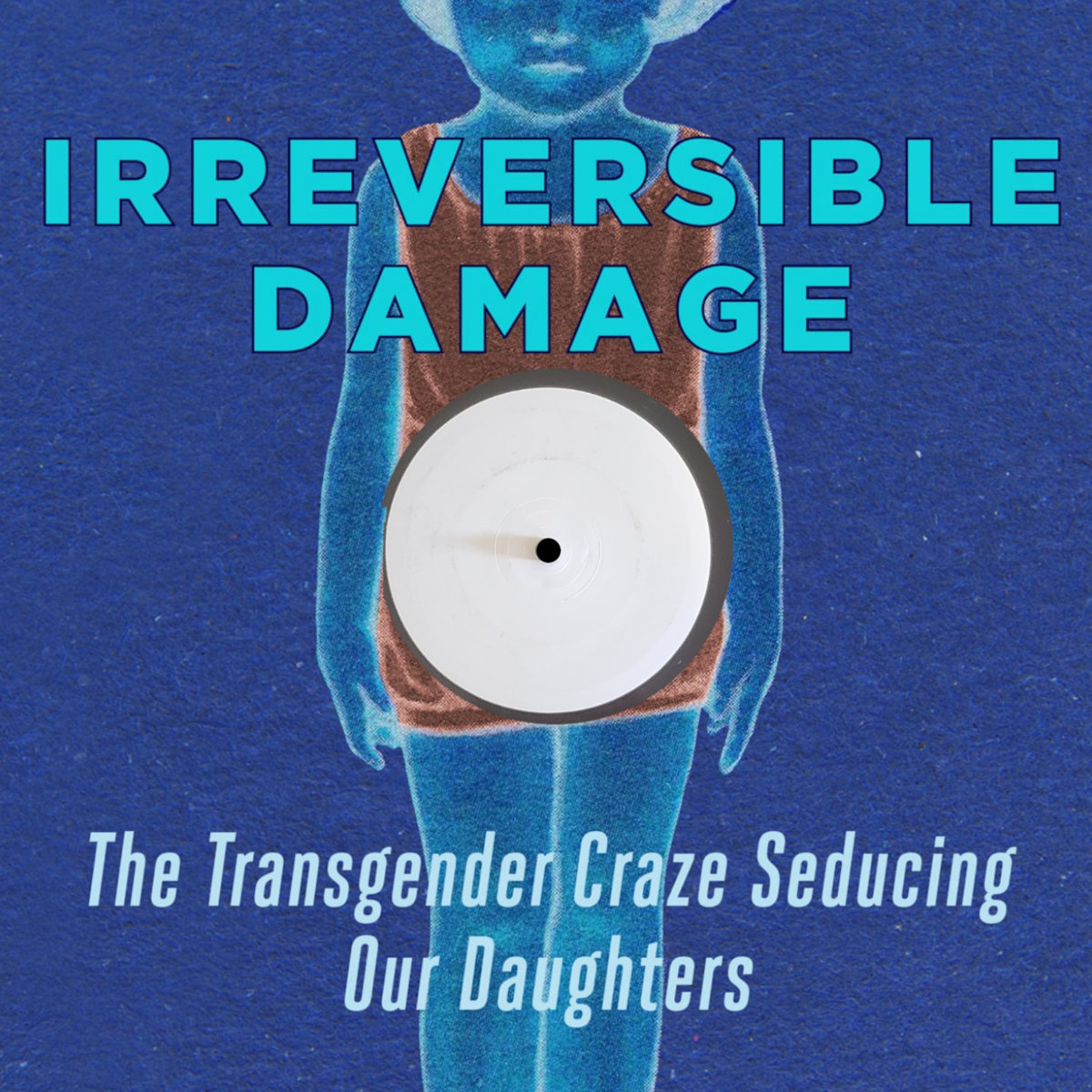 Irreversible Damage | Human Fish Records