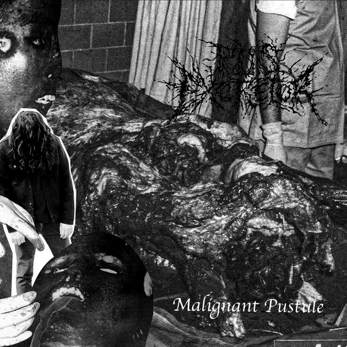 Malignant Pustule - Demo 2025 | PUS EXCRETOR