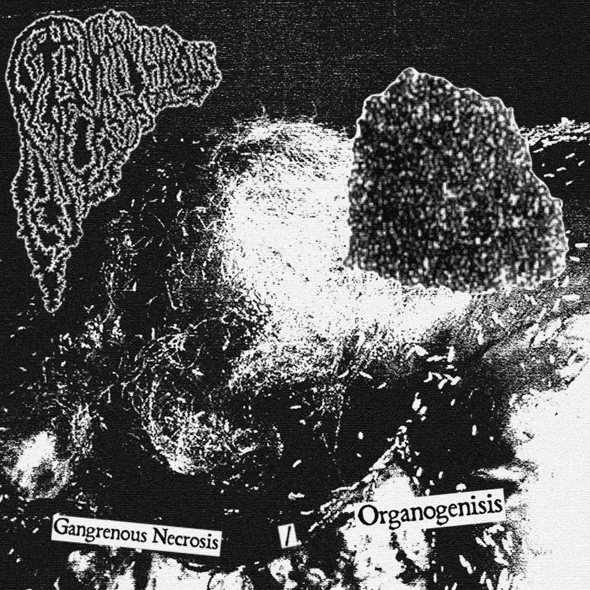 Split w/ Organogenisis | Organogenisis / Gangrenous Necrosis ...