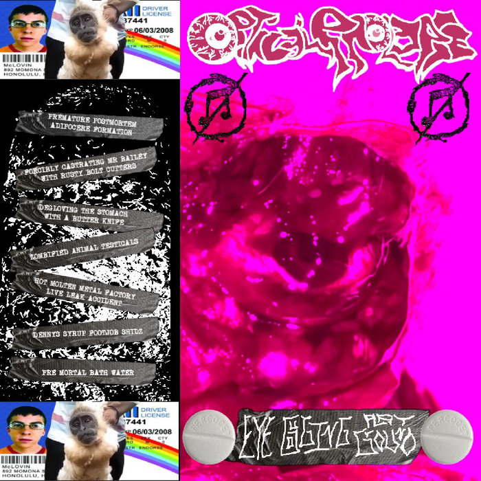 Eye-gouging Playground | Optical Prolapse