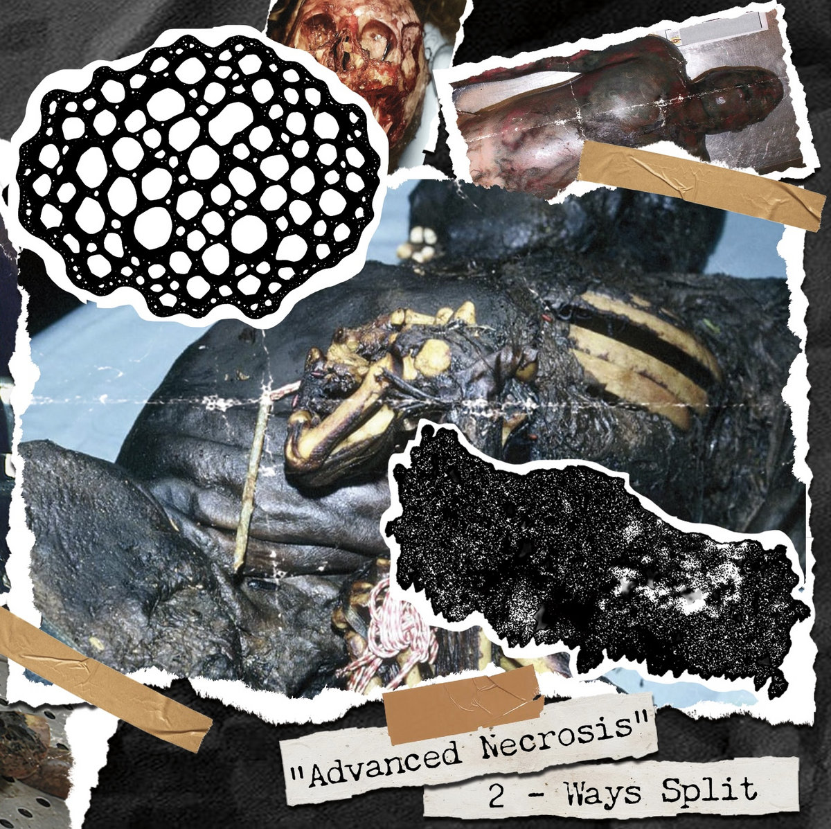 "Advanced Necrosis" (Split W/ Degenerates Boiled Alive In Raw Human ...