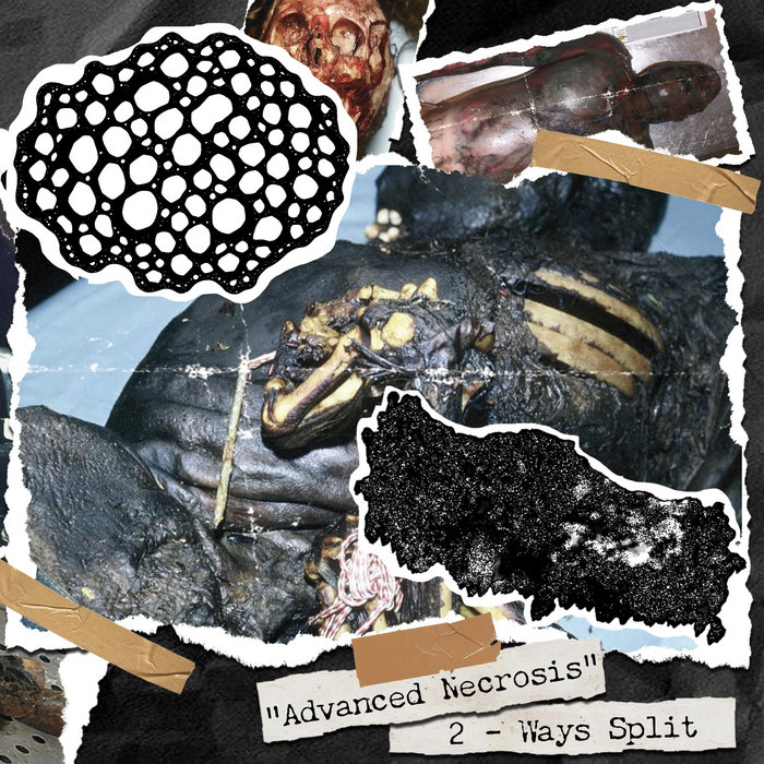 "Advanced Necrosis" (Split W/ Degenerates Boiled Alive In Raw Human ...