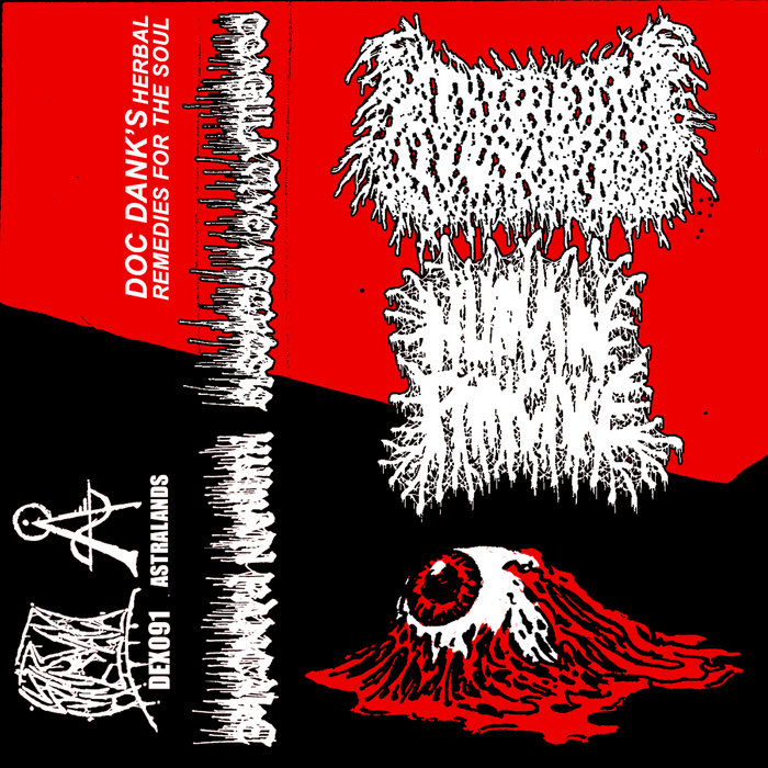 Coagulative Necrosis/Human Pancake | Coagulative Necrosis/Human Pancake ...