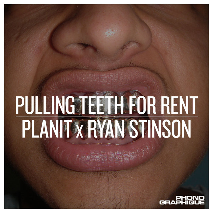 Pulling Teeth For Rent | Planit x Ryan Stinson | Phonographique