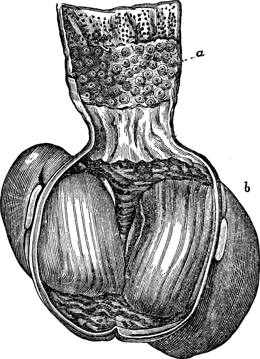 Demo | Ventriculum