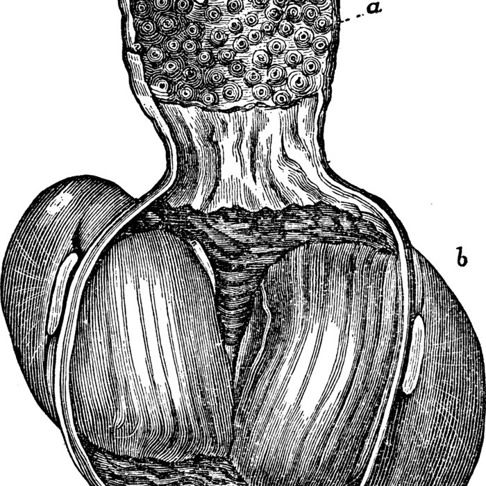 Demo | Ventriculum