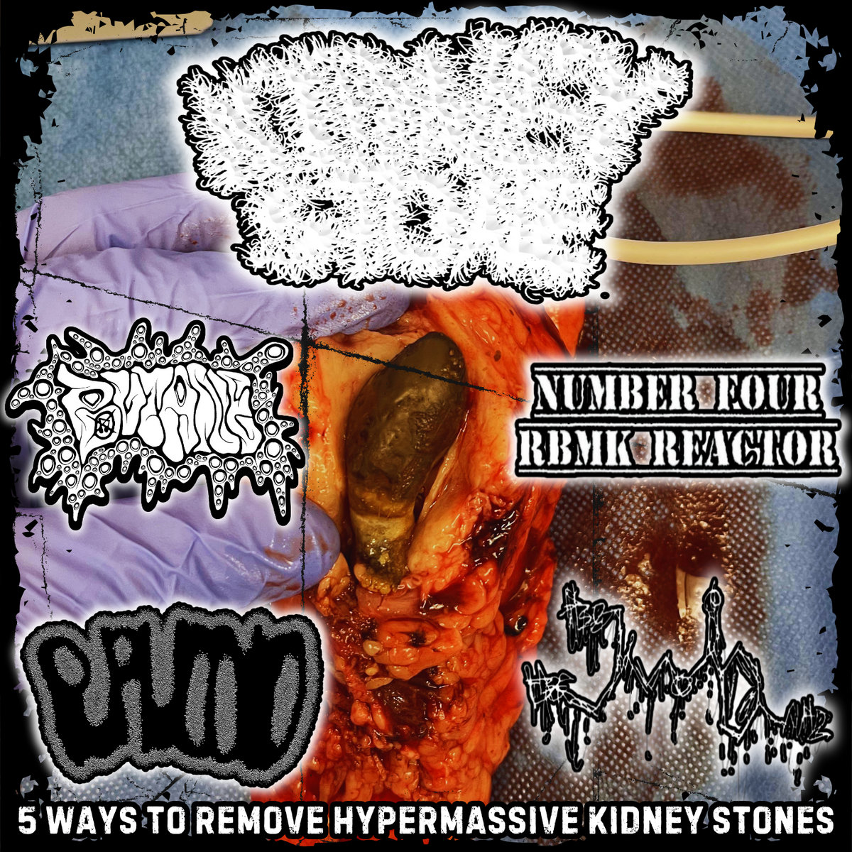 KIDNEYSTONE's Birthday 5-Way Split | Puruloid, KIDNEYSTONE, Heavily Cut ...