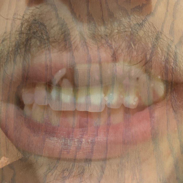 Yuck Mouth Fuzzy Teeth | Closet Space