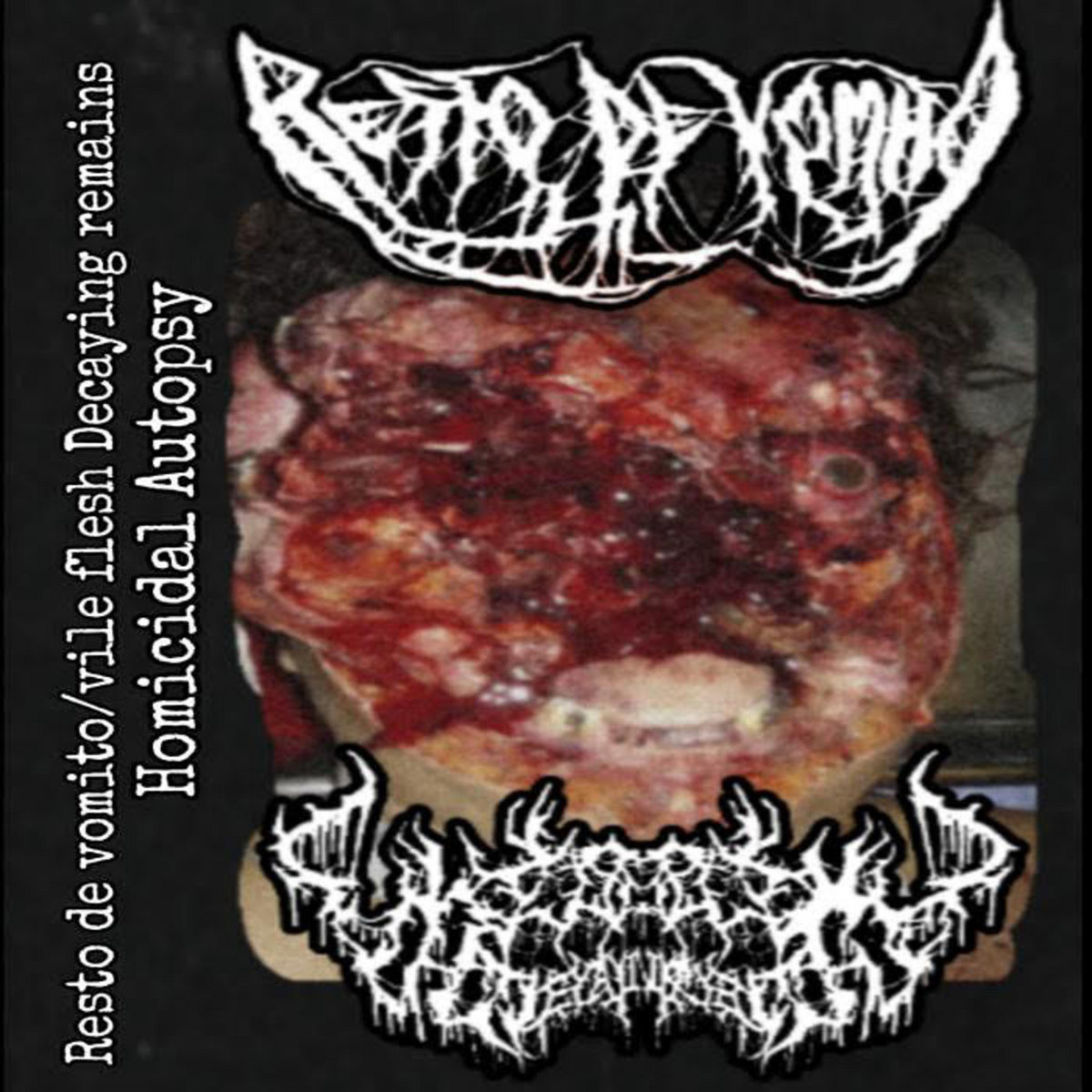 Homicidal Autopsy (split w/ Resto de vomito) | Vile Flesh Decaying Remains