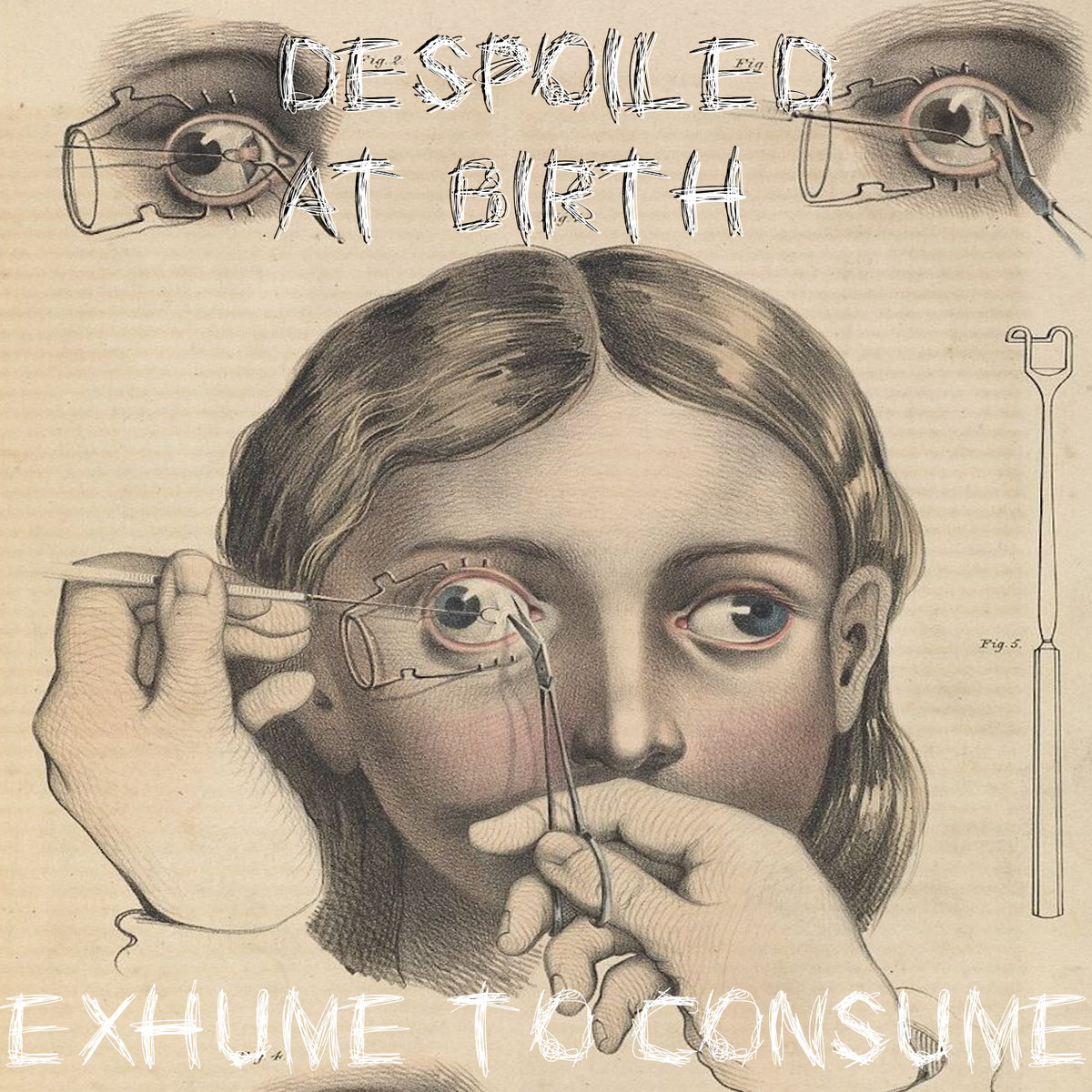 Exhume to Consume (Carcass Cover) | Despoiled at Birth