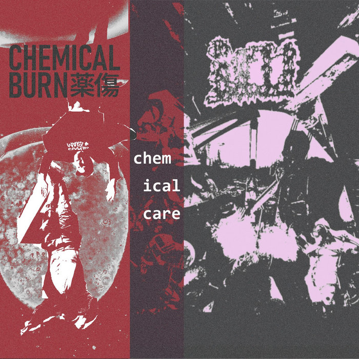 Chemical Care ( Split with Chemical Burn ) | Intensive Care Unit