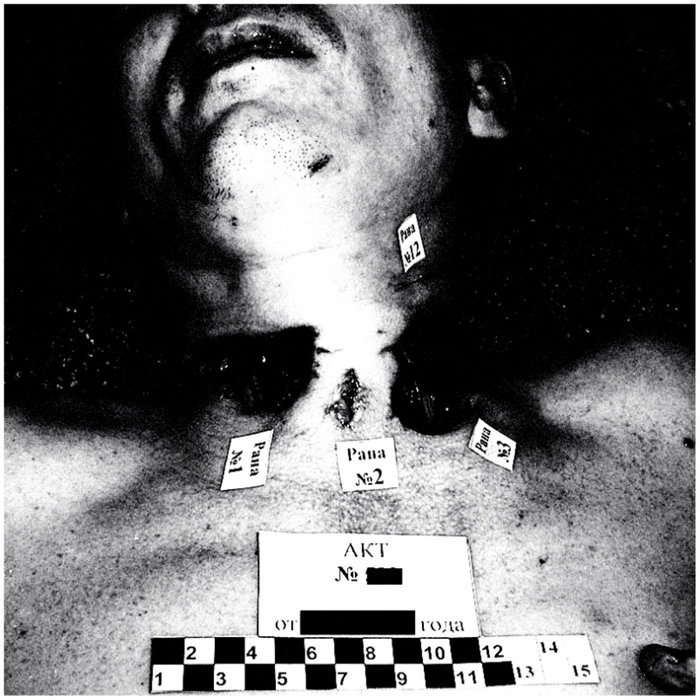 EXSECT-VICTIM | STRANGLED IN A WASTE BAG PRODUCTIONS