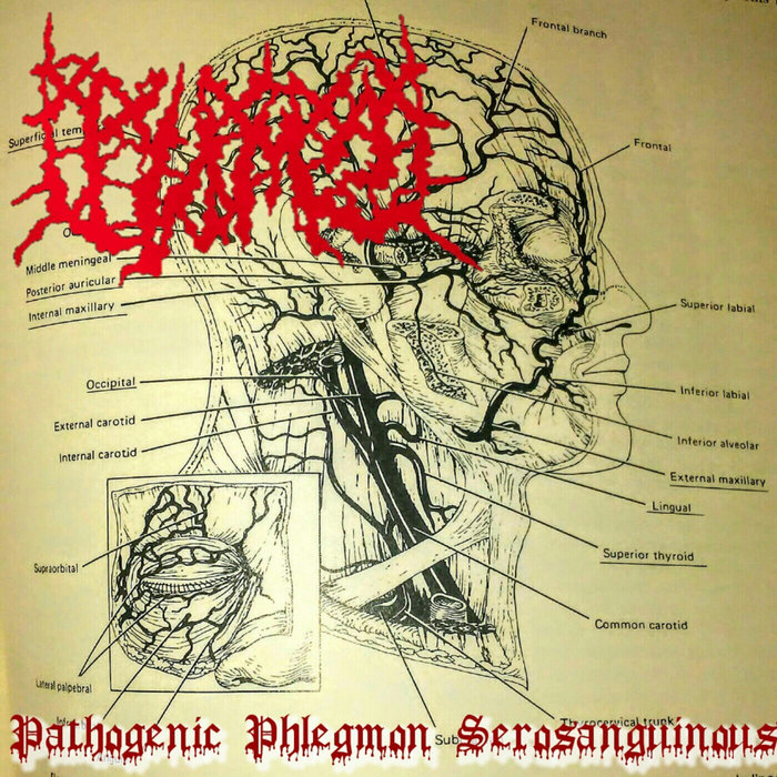 Pathogenic Phlegmon Serosanguinous | trauma nurse with sepsis