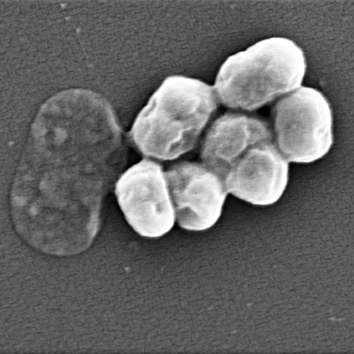 split with Human Pancake | Gas Gangrene
