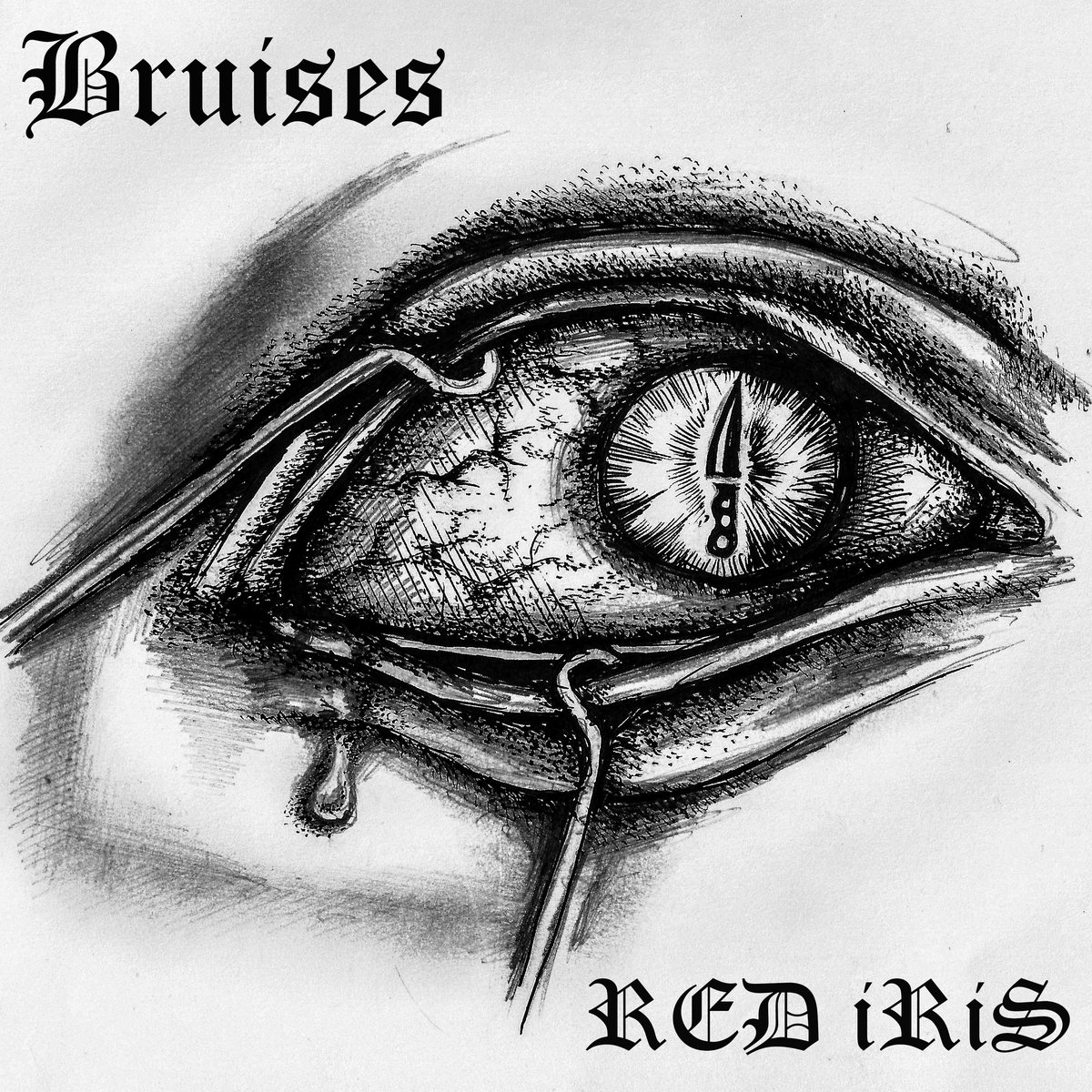 Bruises | RED iRiS