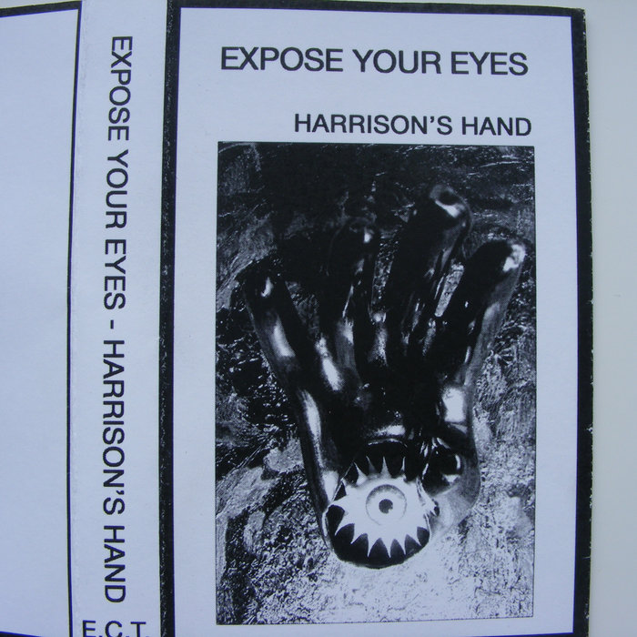 HARRISON'S HAND | EXPOSE YOUR EYES | Xemporium