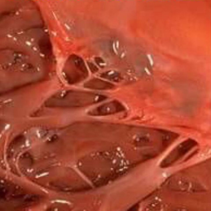 Vascular Pandemonium | BLOOD BURSTER