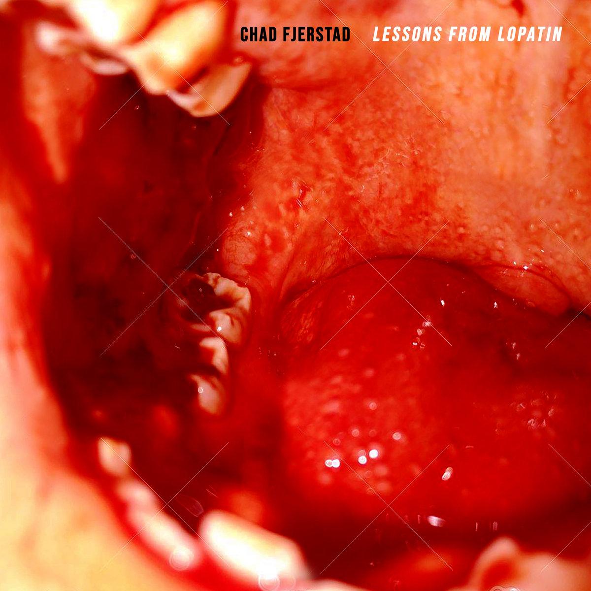 Lessons From Lopatin | Chad Fjerstad
