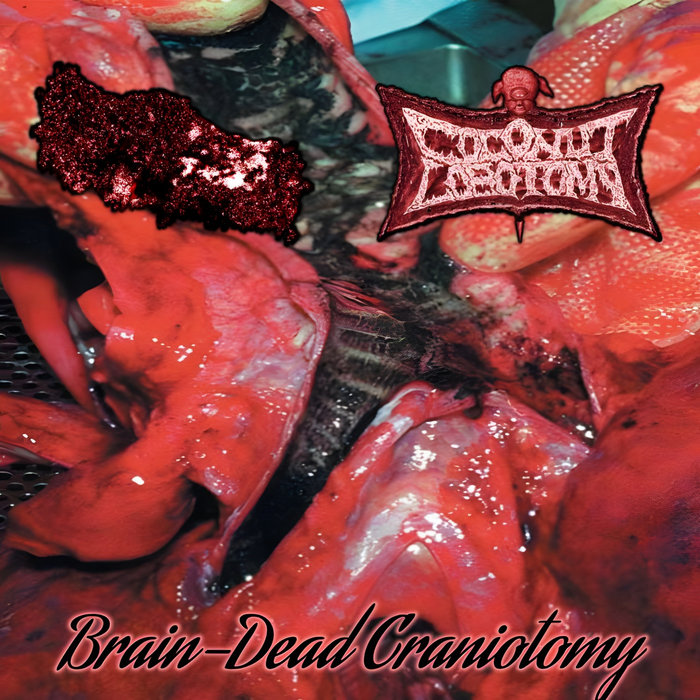 Pus Crusted Seborrheic Dermatitis | Syphilitic Brain Rot | Coconut Lobotomy