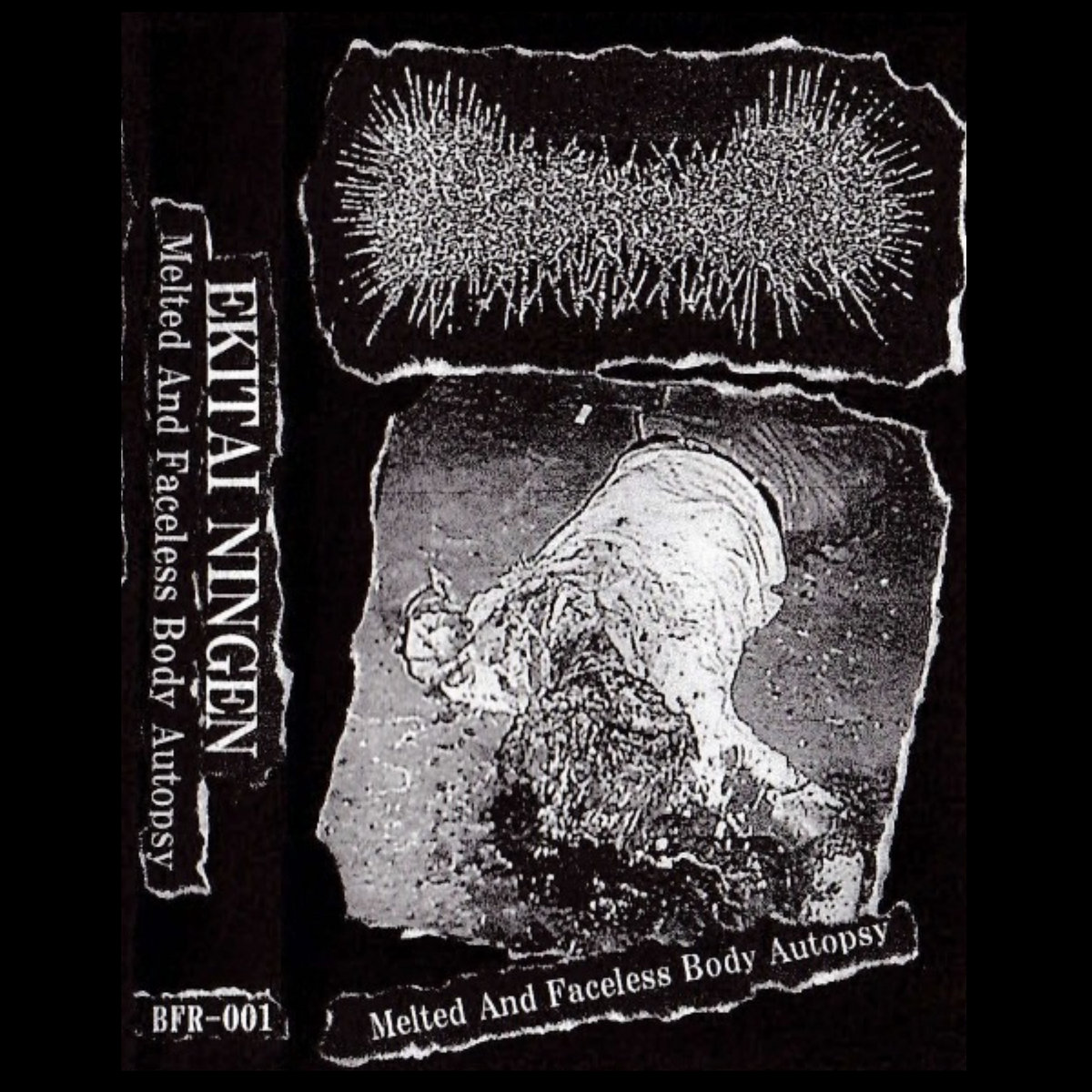 (BFR-001) Melted And Faceless Body Autopsy | EKITAI NINGEN | Bothersome ...