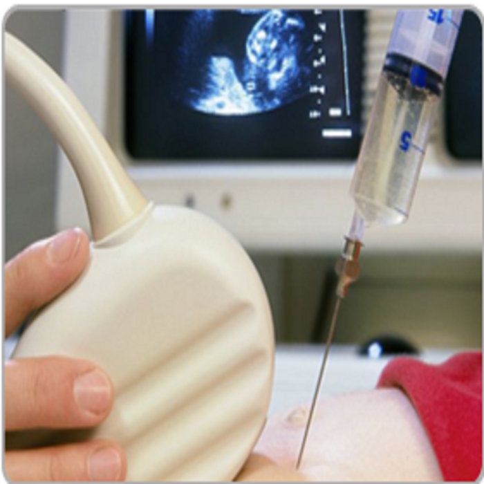 Amniocentesis Test in Zirakpur | CARE DIAGNOSTIC CENTRE