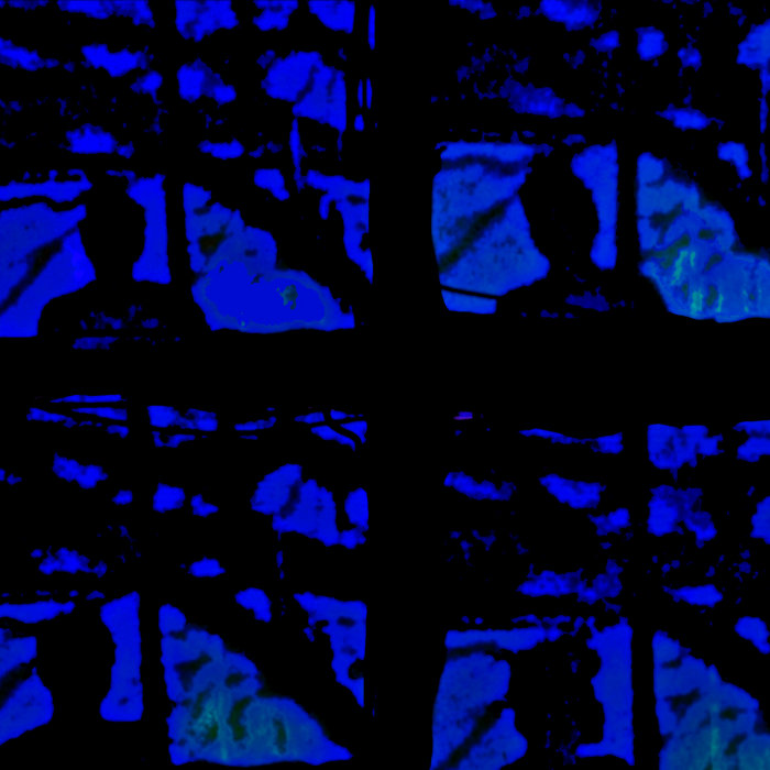 Void Illness | Moon Bodies