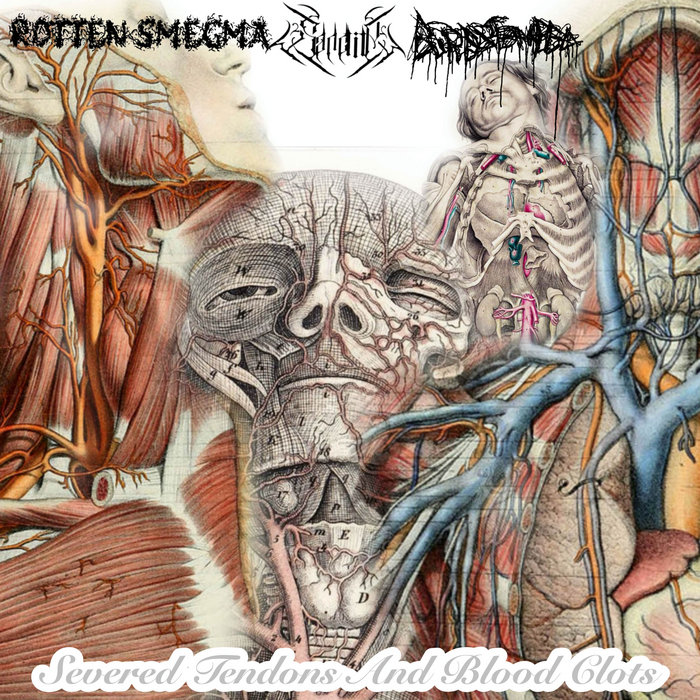 Severed Tendons and Blood Clots (3 way split with Curb stomped ...