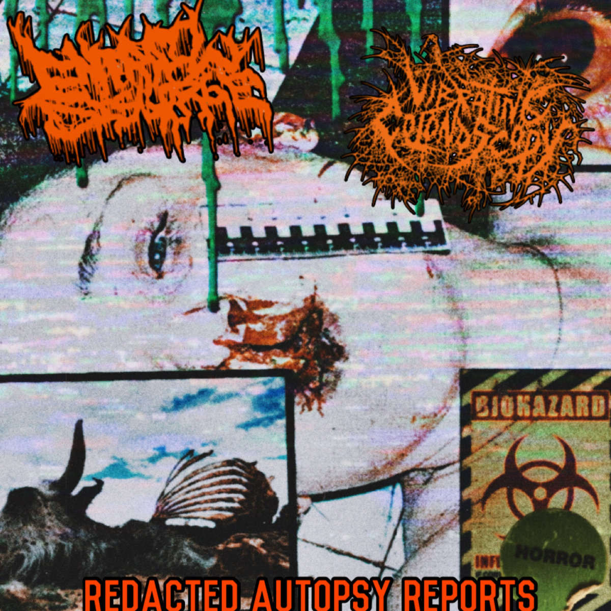 Redacted Autopsy Reports (split) | Entrail Disgorge, VIBRATING ...