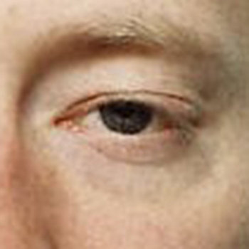 Music | pictures of thom yorke's lazy eye