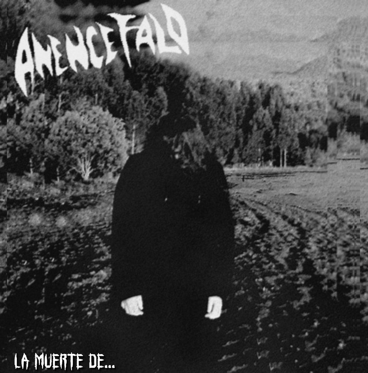 la muerte de anencefalo | anencefalo | ANENCEFALO