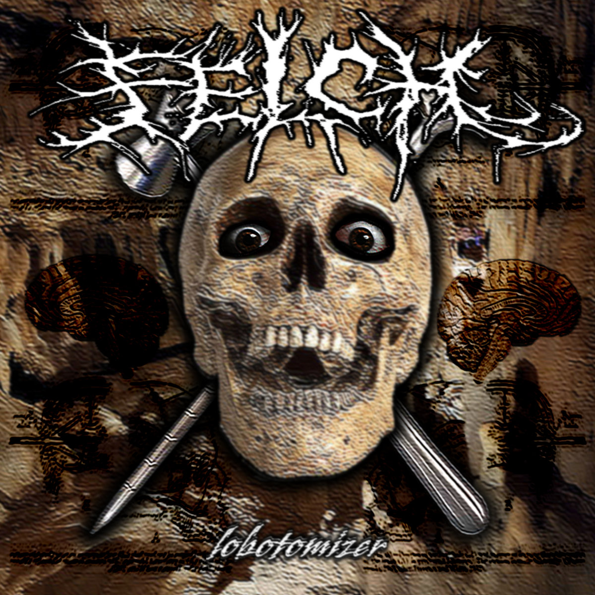 Lobotomizer | FELCH