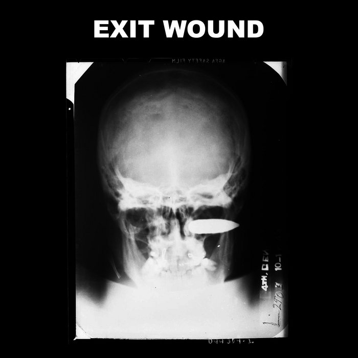 Exit Wound | Exit Wound