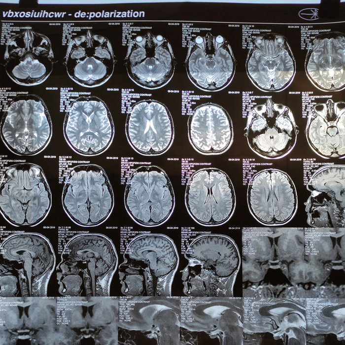 Refraction EP 003 - Depolarization | vbxosiuihcwr | Radiance