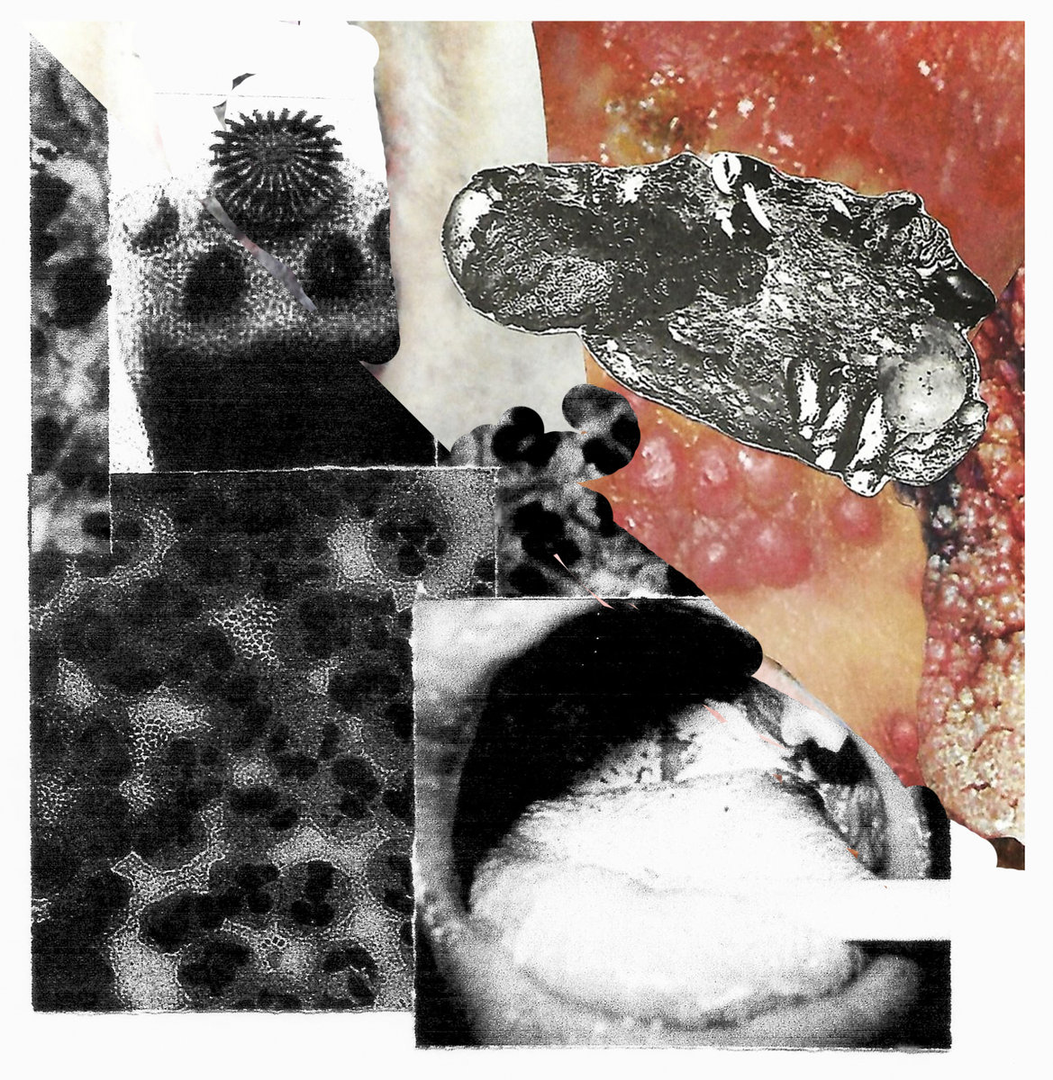 Hemorrhagic Pyrexia Virus / Gonococus Split | HxPxVx // Gonococus ...