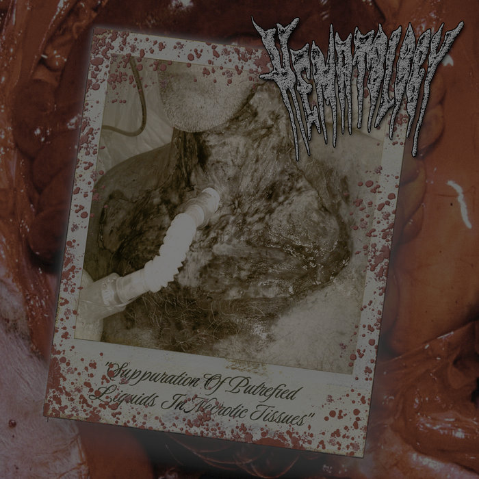 Suppuration Of Putrefied Liquids In Necrotic Tissues | Hematology ...