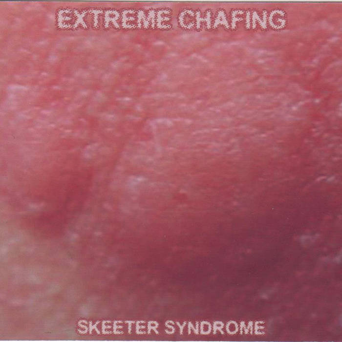 Skeeter Syndrome
