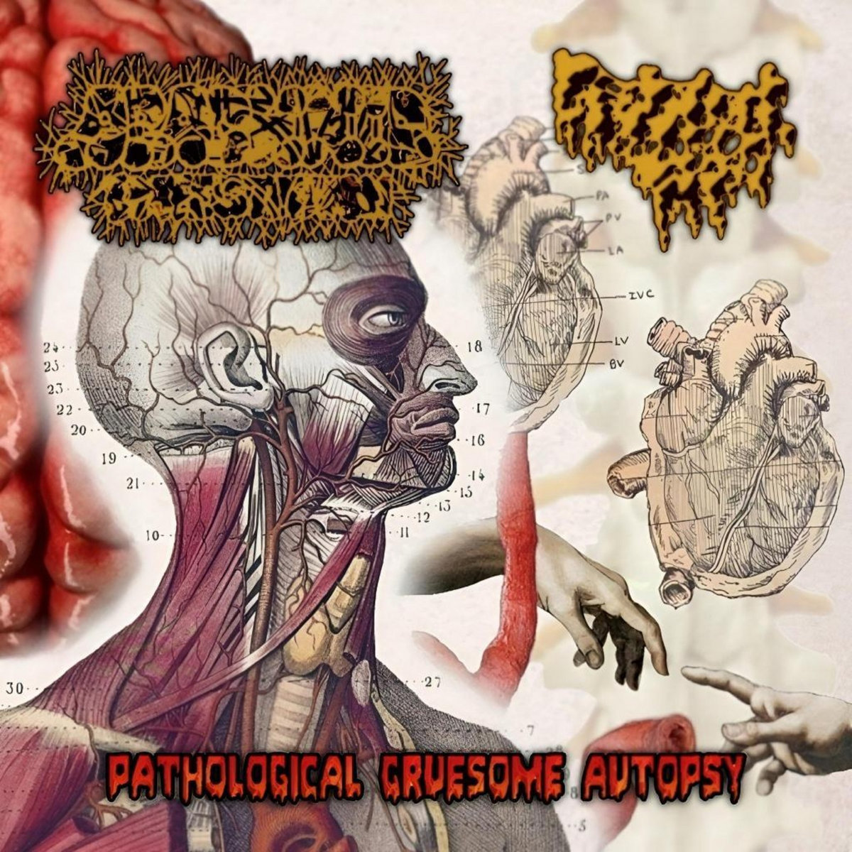 Pathological Gruesome Autopsy | DxBxAxIxRxHxFx / Arachnid Infestation ...