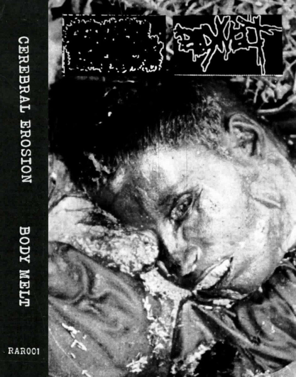 Body Melt / Cerebral Erosion Split Cs | Body Melt