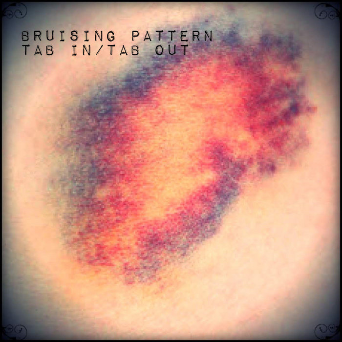 Harsh Bruises | Bruising Pattern / TAB IN/TAB OUT | Basement Corner ...